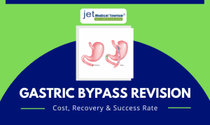 How Much Does Gastric Bypass Revision Cost? | Jet Medical Tourism®