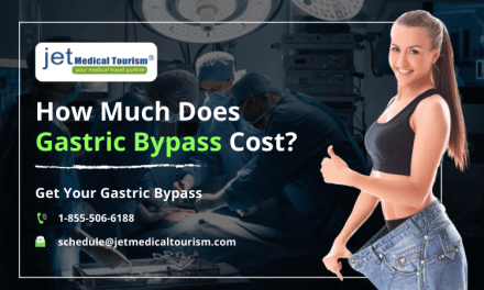 Gastric Bypass Results - Jet Medical Tourism® in Mexico