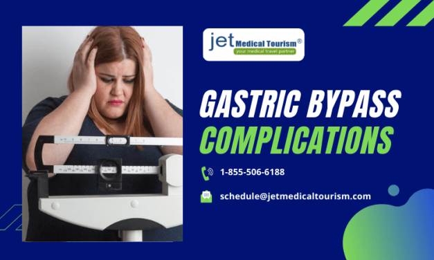 Gastric Bypass Complications Years Later Archives - Jet Medical Tourism® in Mexico