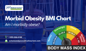 Morbid obesity BMI chart: Am I morbidly obese? Jet Medical Tourism®