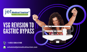 Vertical Sleeve Revision to Gastric Bypass | VSG to RNY