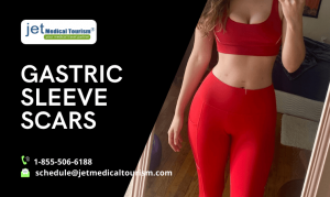 Gastric Sleeve Scars - Minimize Scars to Stomach - Jet Medical Tourism® in Mexico
