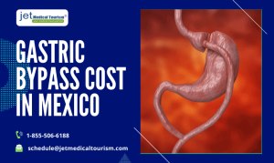 Gastric Bypass Cost in Mexico - Jet Medical Tourism®